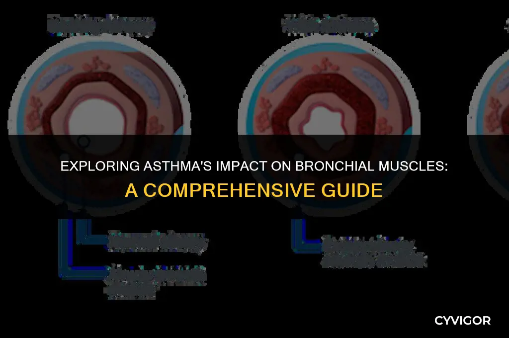 Exploring Asthma's Impact On Bronchial Muscles: A Comprehensive Guide ...