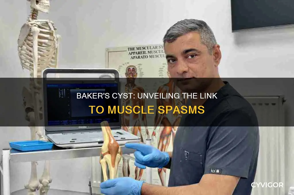 Baker's Cyst: Unveiling The Link To Muscle Spasms | CyVigor