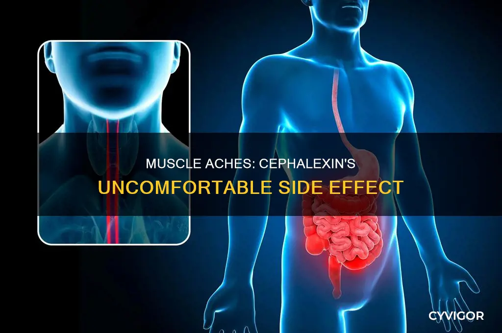 Muscle Aches: Cephalexin's Uncomfortable Side Effect | CyVigor