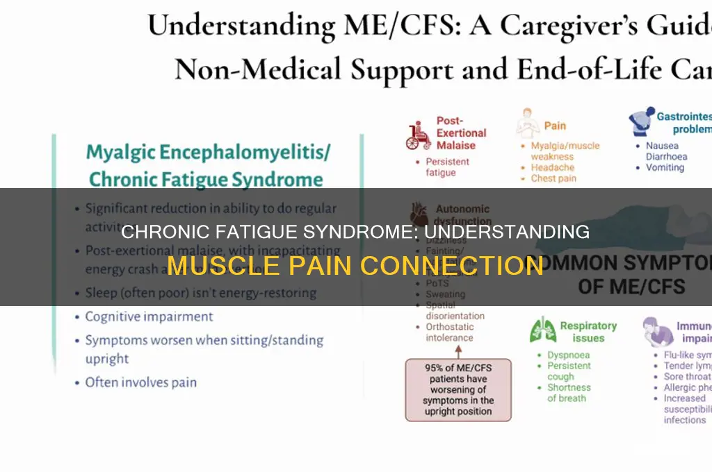 Chronic Fatigue Syndrome: Understanding Muscle Pain Connection | CyVigor
