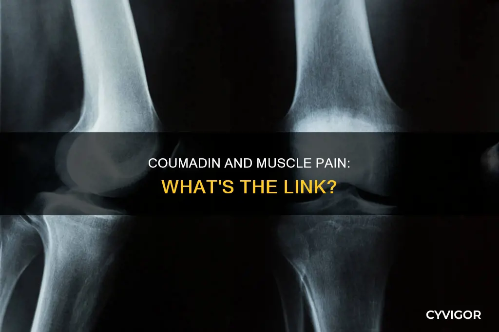 Coumadin And Muscle Pain: What's The Link? | CyVigor