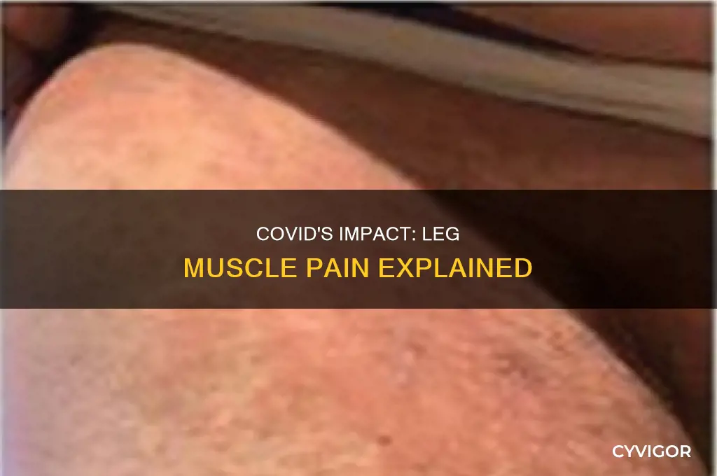 Covid's Impact: Leg Muscle Pain Explained | CyVigor