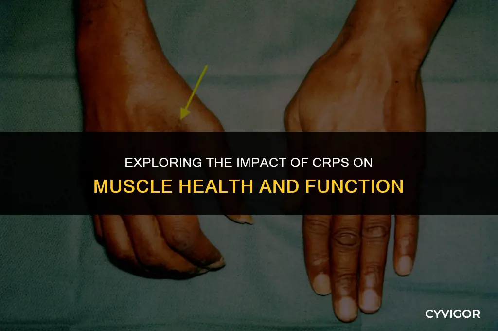 Exploring The Impact Of Crps On Muscle Health And Function | CyVigor