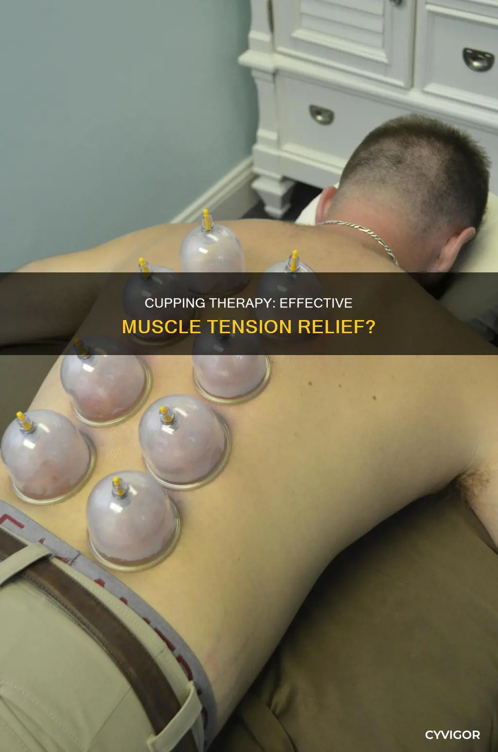 Cupping Therapy: Effective Muscle Tension Relief? | CyVigor