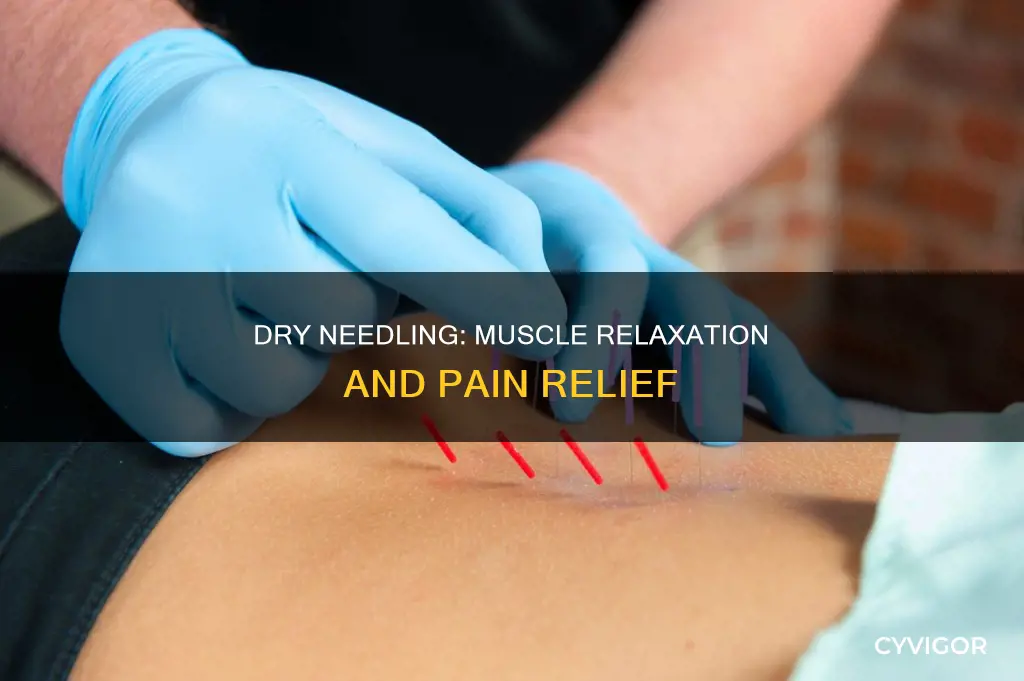 Dry Needling: Muscle Relaxation And Pain Relief | CyVigor