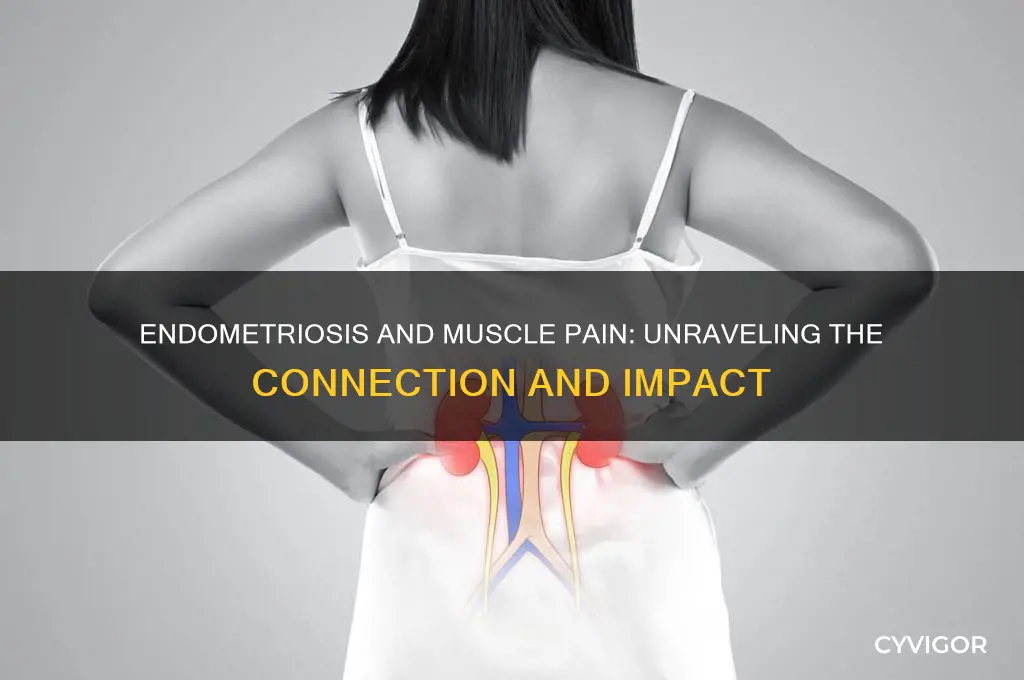 Endometriosis And Muscle Pain: Unraveling The Connection And Impact ...