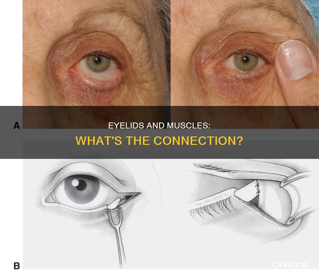 Eyelids And Muscles: What's The Connection? | CyVigor
