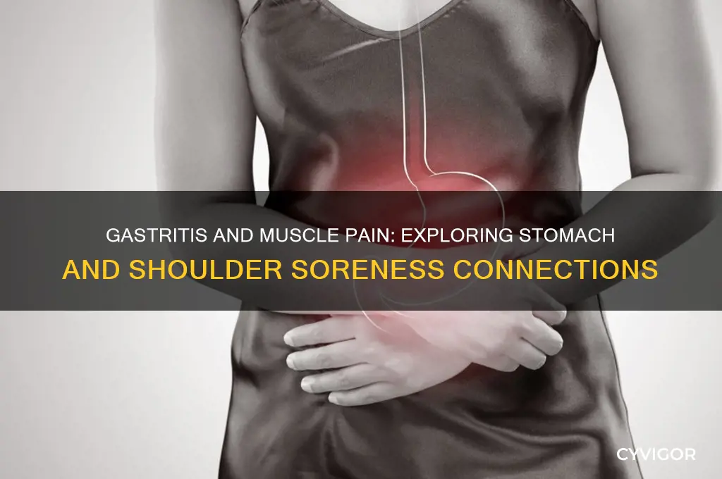 Gastritis And Muscle Pain: Exploring Stomach And Shoulder Soreness ...