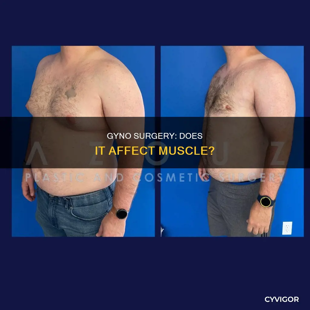 Gyno Surgery: Does It Affect Muscle? | CyVigor