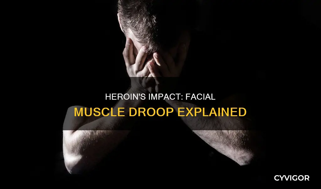 Heroin's Impact: Facial Muscle Droop Explained | CyVigor