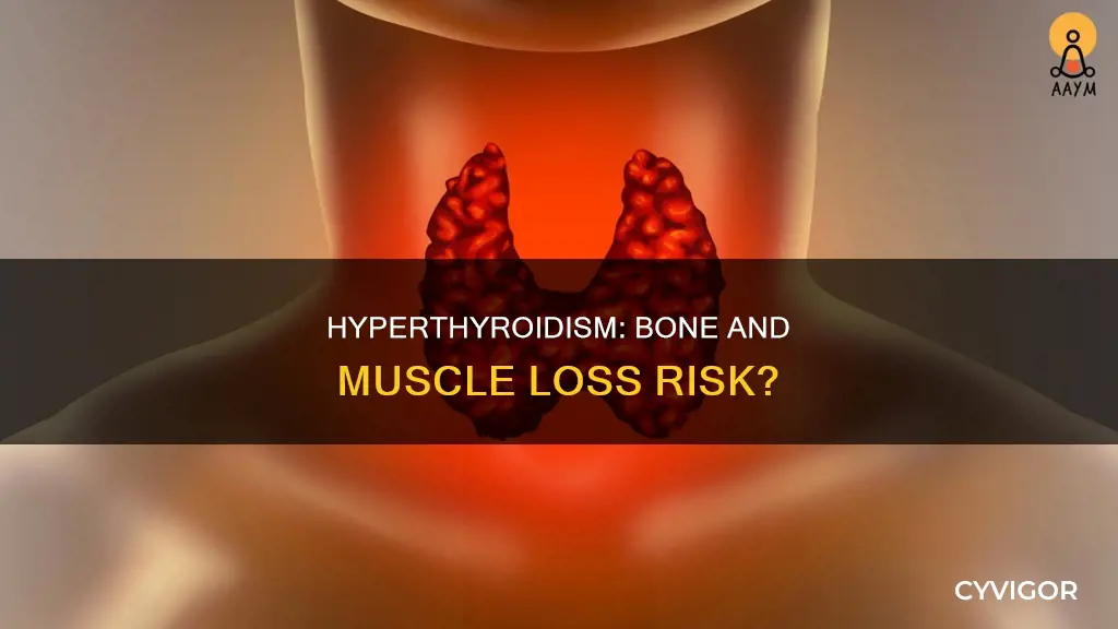 Hyperthyroidism: Bone And Muscle Loss Risk? | CyVigor