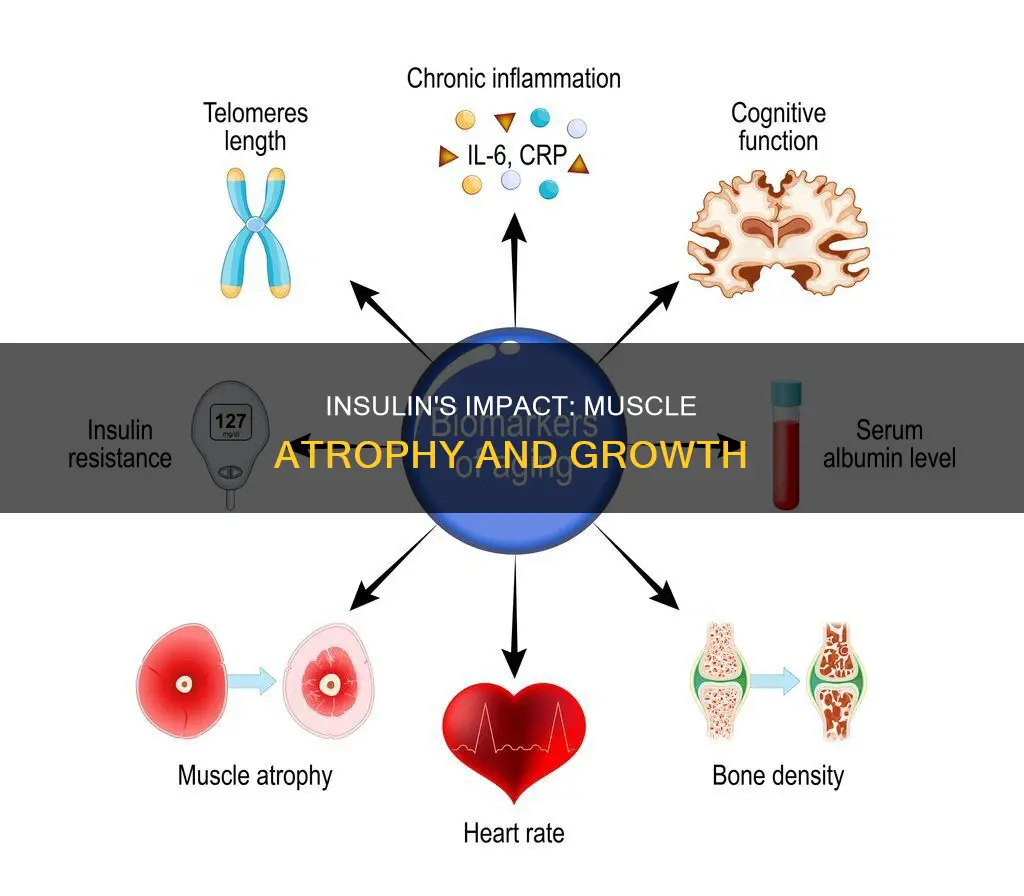 Insulin's Impact: Muscle Atrophy And Growth | CyVigor