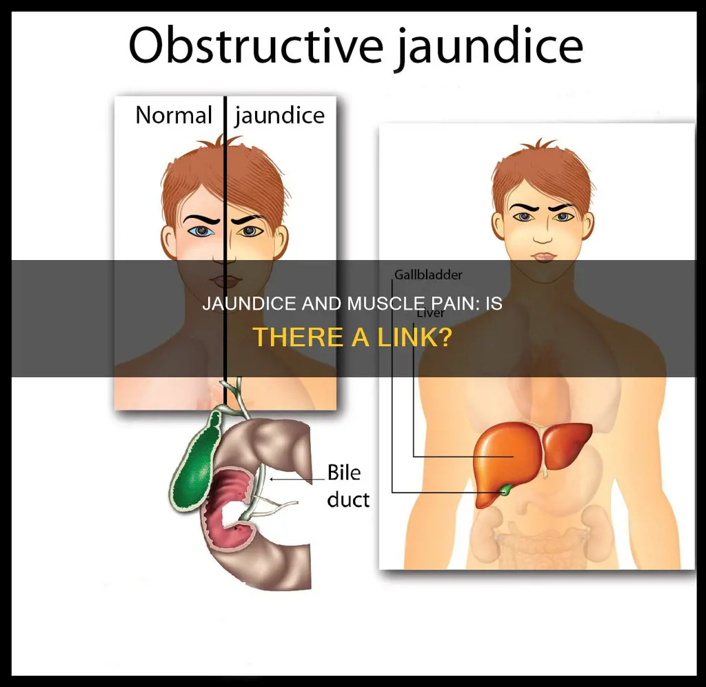 Jaundice And Muscle Pain: Is There A Link? | CyVigor