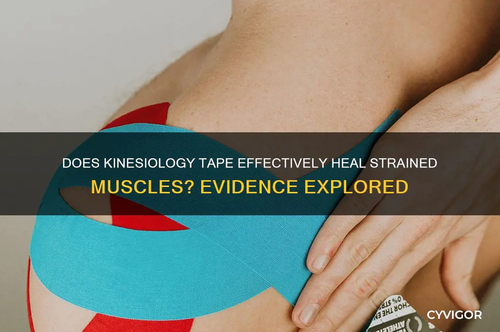 Does Kinesiology Tape Effectively Heal Strained Muscles? Evidence ...