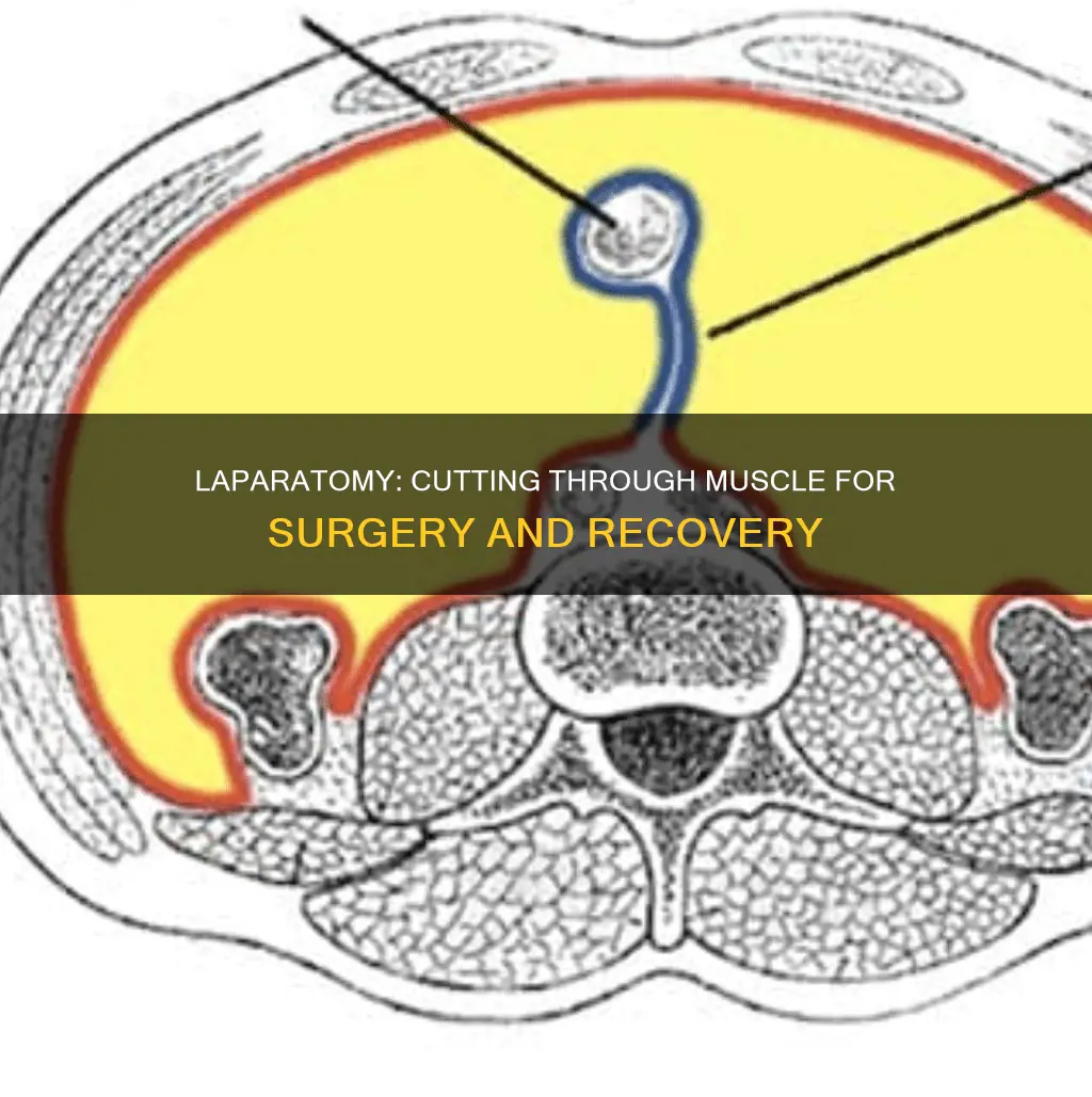 Laparatomy: Cutting Through Muscle For Surgery And Recovery | CyVigor