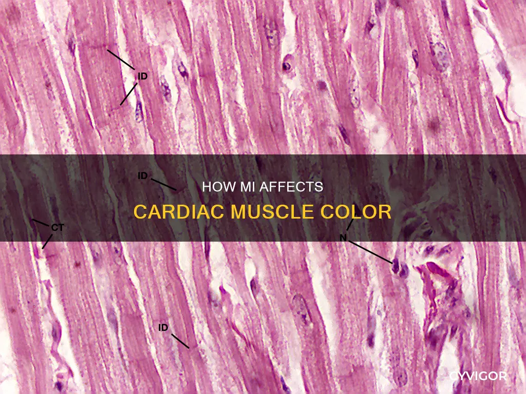 How Mi Affects Cardiac Muscle Color | CyVigor