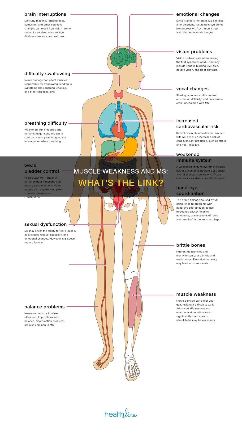 Muscle Weakness And Ms: What's The Link? | CyVigor