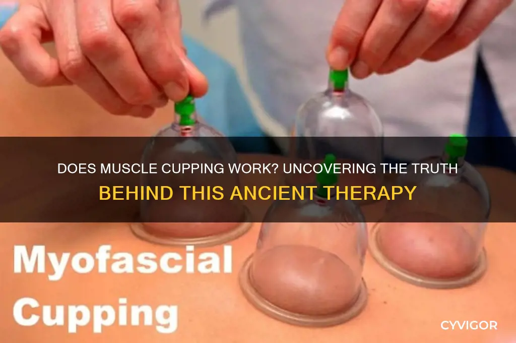 Does Muscle Cupping Work? Uncovering The Truth Behind This Ancient ...