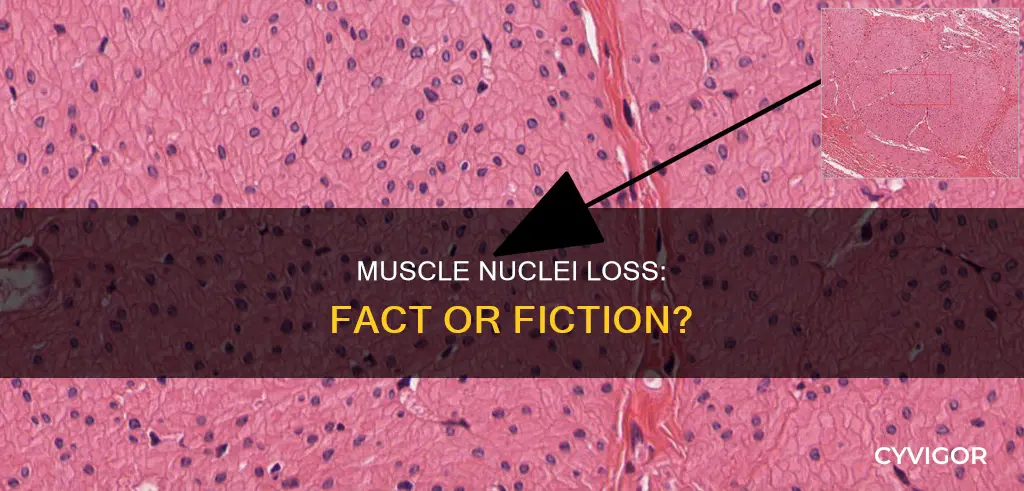 Muscle Nuclei Loss: Fact Or Fiction? | CyVigor