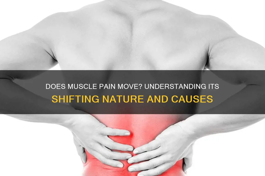 Does Muscle Pain Move? Understanding Its Shifting Nature And Causes ...