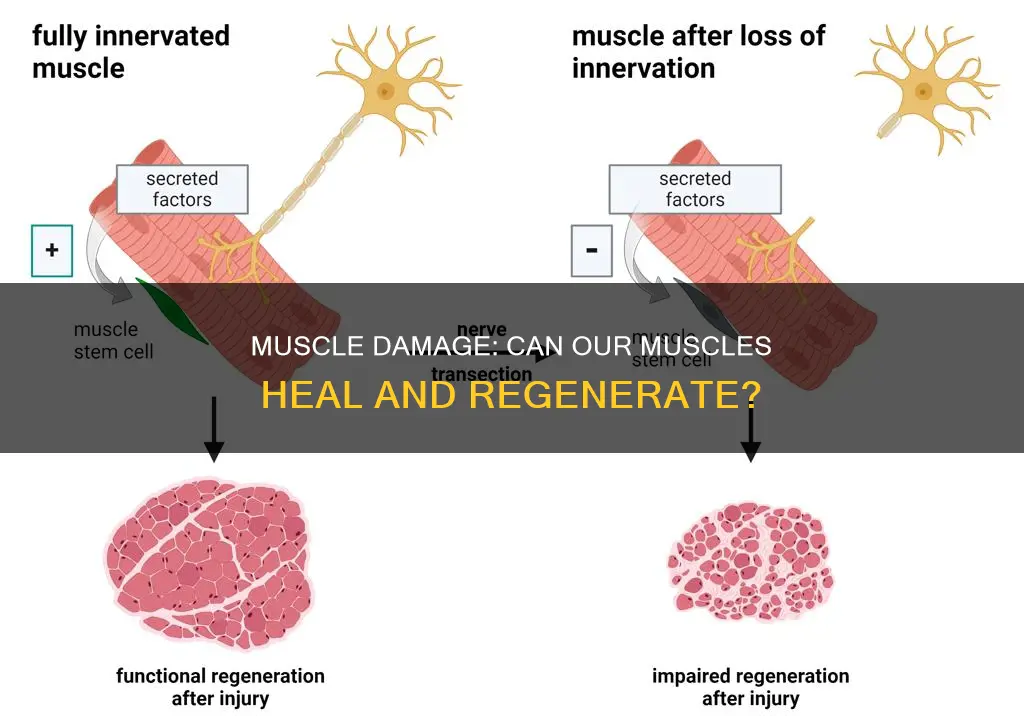 Muscle Damage: Can Our Muscles Heal And Regenerate? | CyVigor