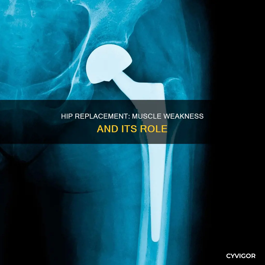 Hip Replacement: Muscle Weakness And Its Role | CyVigor