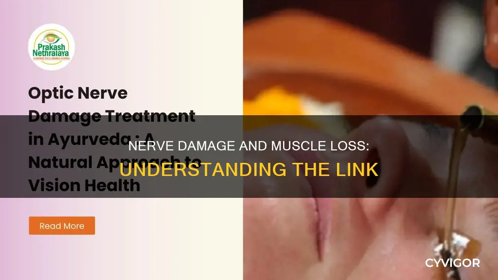 Nerve Damage And Muscle Loss: Understanding The Link | CyVigor