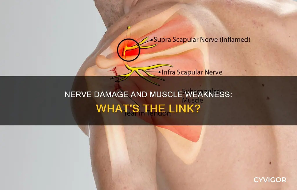 Nerve Damage And Muscle Weakness: What's The Link? | CyVigor