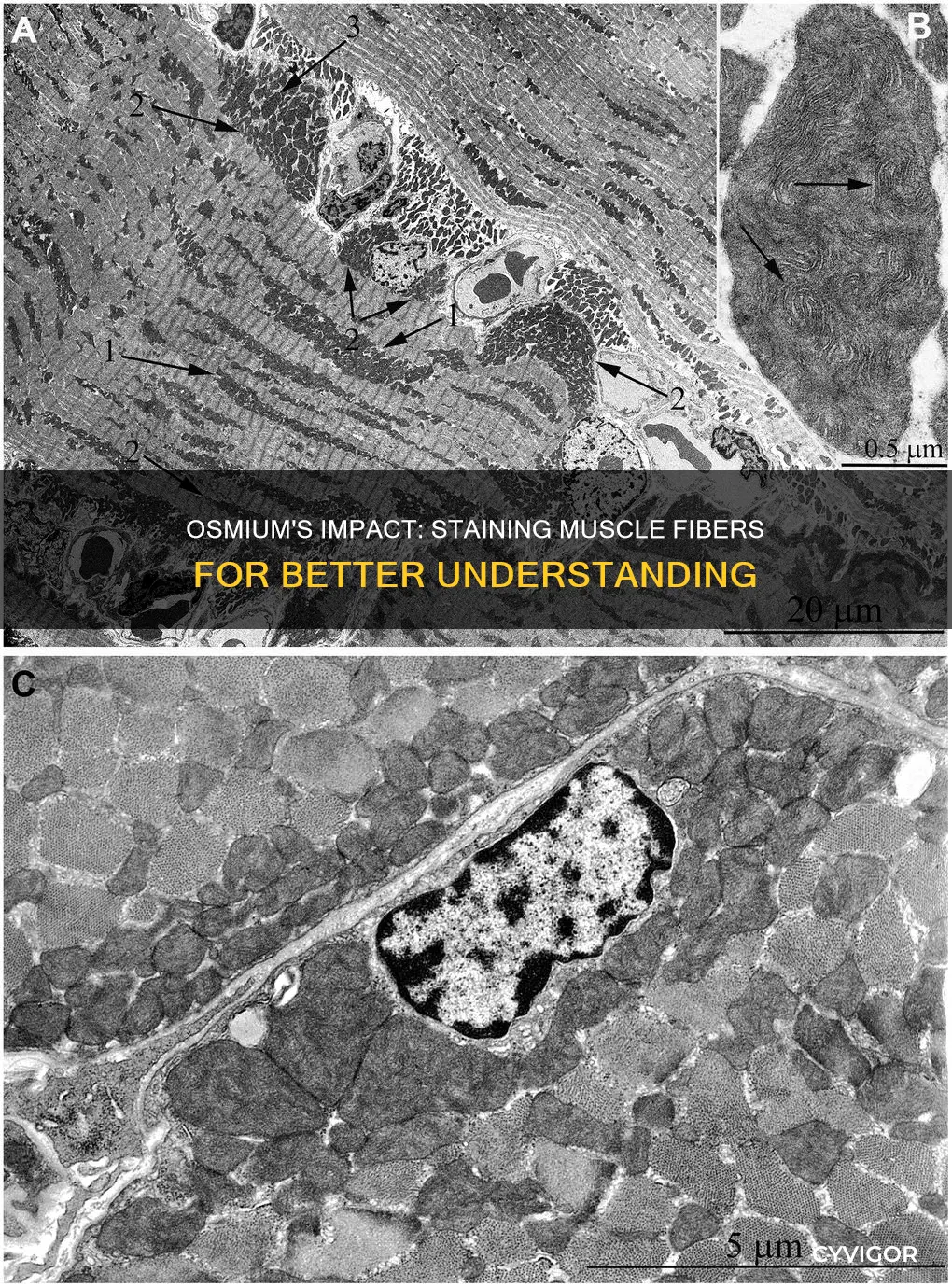 Osmium's Impact: Staining Muscle Fibers For Better Understanding | CyVigor