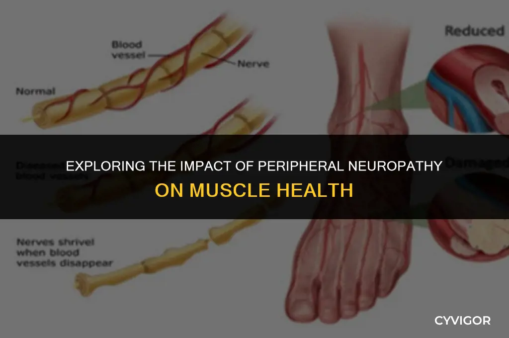 Exploring The Impact Of Peripheral Neuropathy On Muscle Health | CyVigor