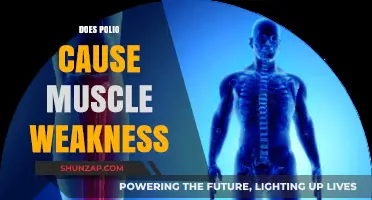 Polio's Impact: Muscle Atrophy And Recovery | CyVigor