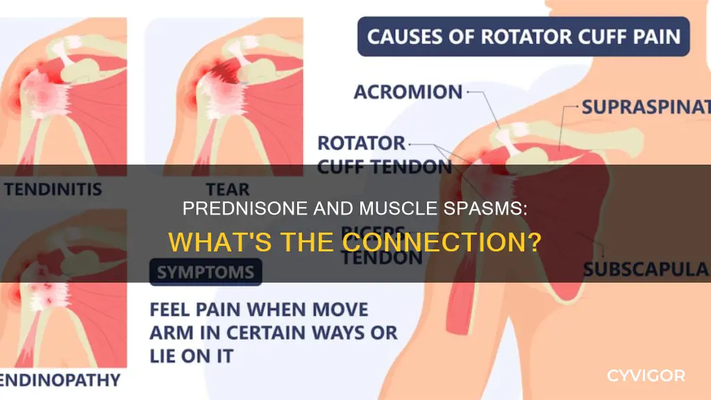 Prednisone And Muscle Spasms: What's The Connection? | CyVigor