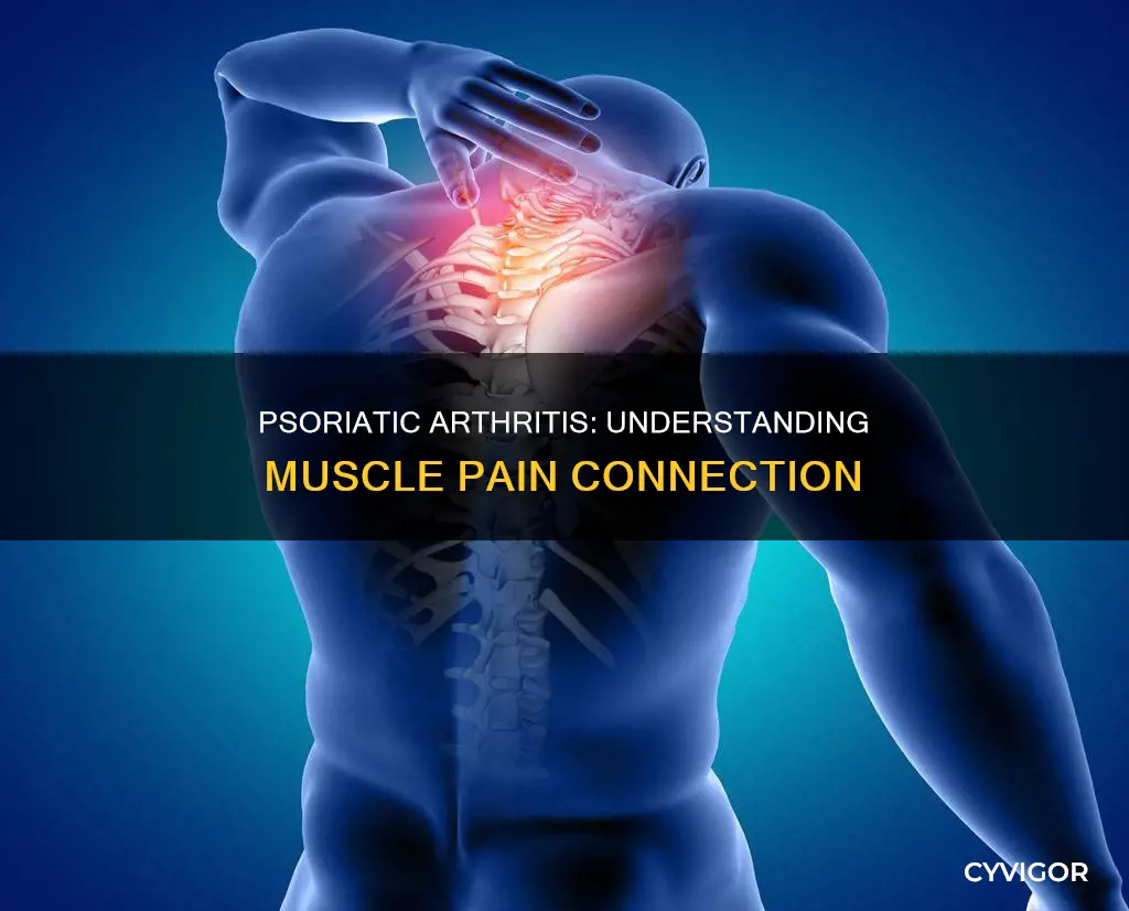 Psoriatic Arthritis: Understanding Muscle Pain Connection | CyVigor