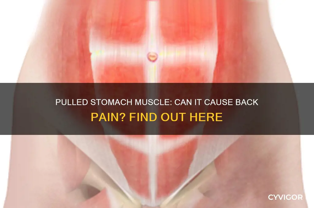 Pulled Stomach Muscle: Can It Cause Back Pain? Find Out Here | CyVigor