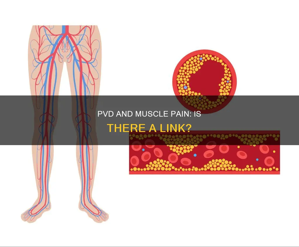 Pvd And Muscle Pain: Is There A Link? | CyVigor