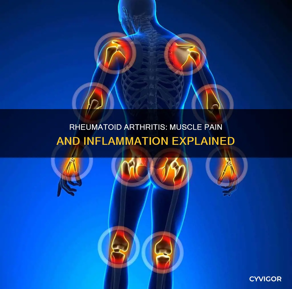 Rheumatoid Arthritis: Muscle Pain And Inflammation Explained | CyVigor