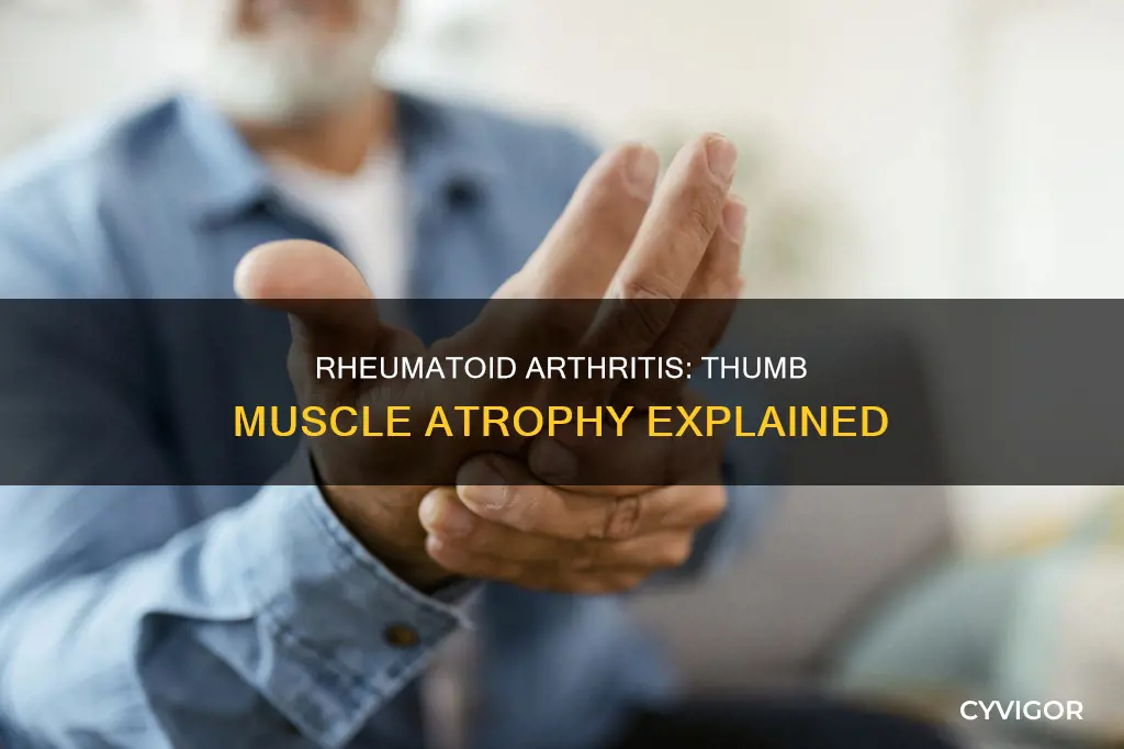 Rheumatoid Arthritis: Thumb Muscle Atrophy Explained | CyVigor