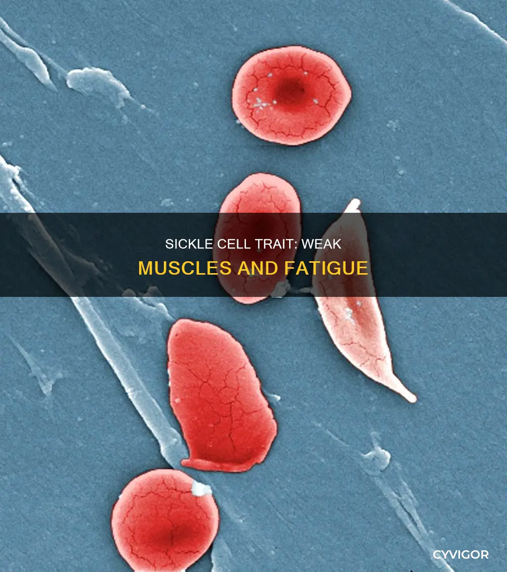 Sickle Cell Trait: Weak Muscles And Fatigue | CyVigor