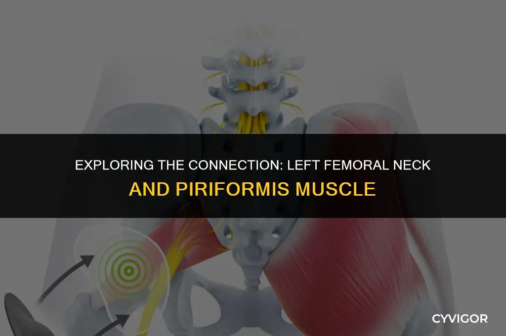 Exploring The Connection: Left Femoral Neck And Piriformis Muscle | CyVigor