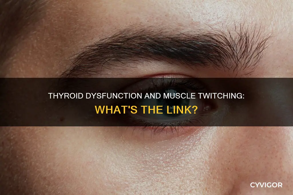 Thyroid Dysfunction And Muscle Twitching: What's The Link? | CyVigor