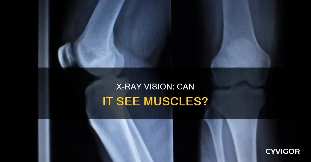 X-Ray Vision: Can It See Muscles? | CyVigor