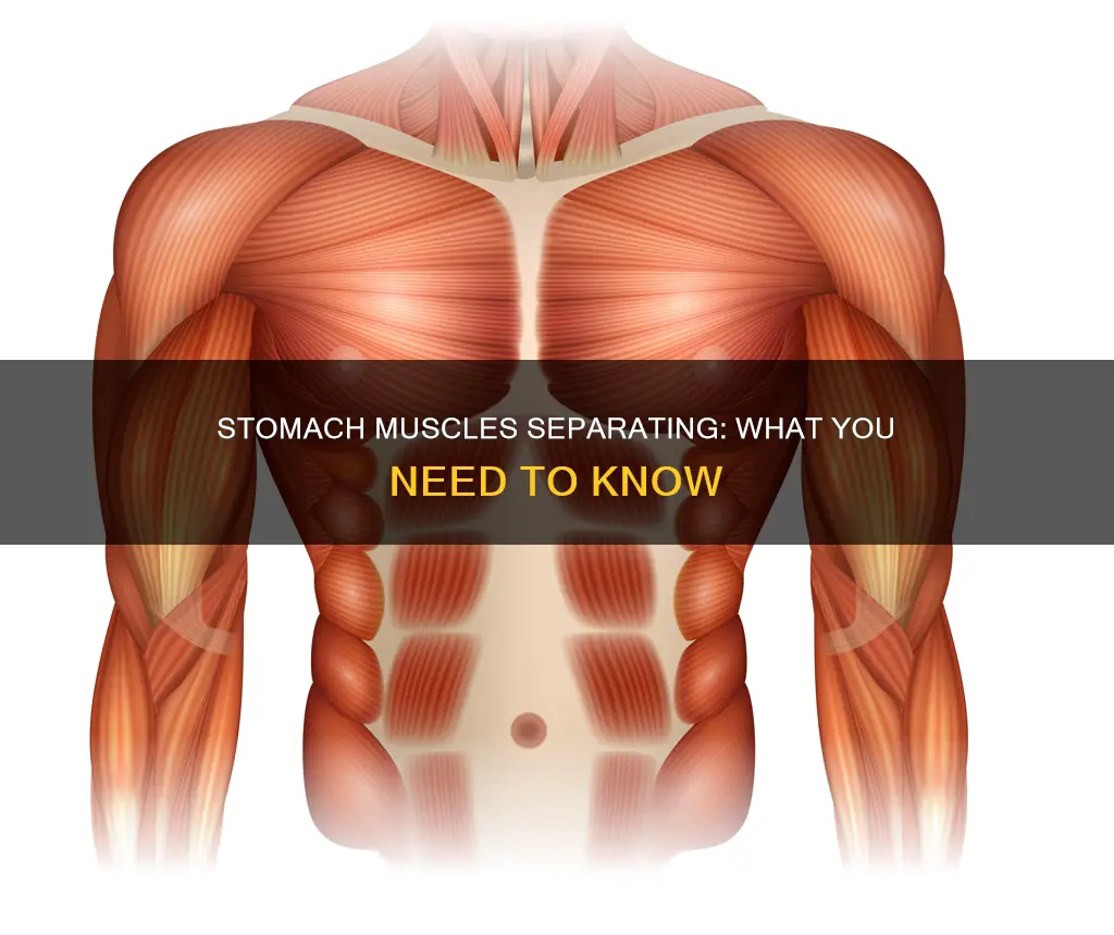 Stomach Muscles Separating: What You Need To Know | CyVigor