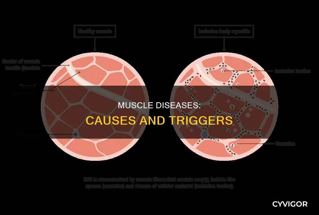 Muscle Diseases: Causes And Triggers | CyVigor