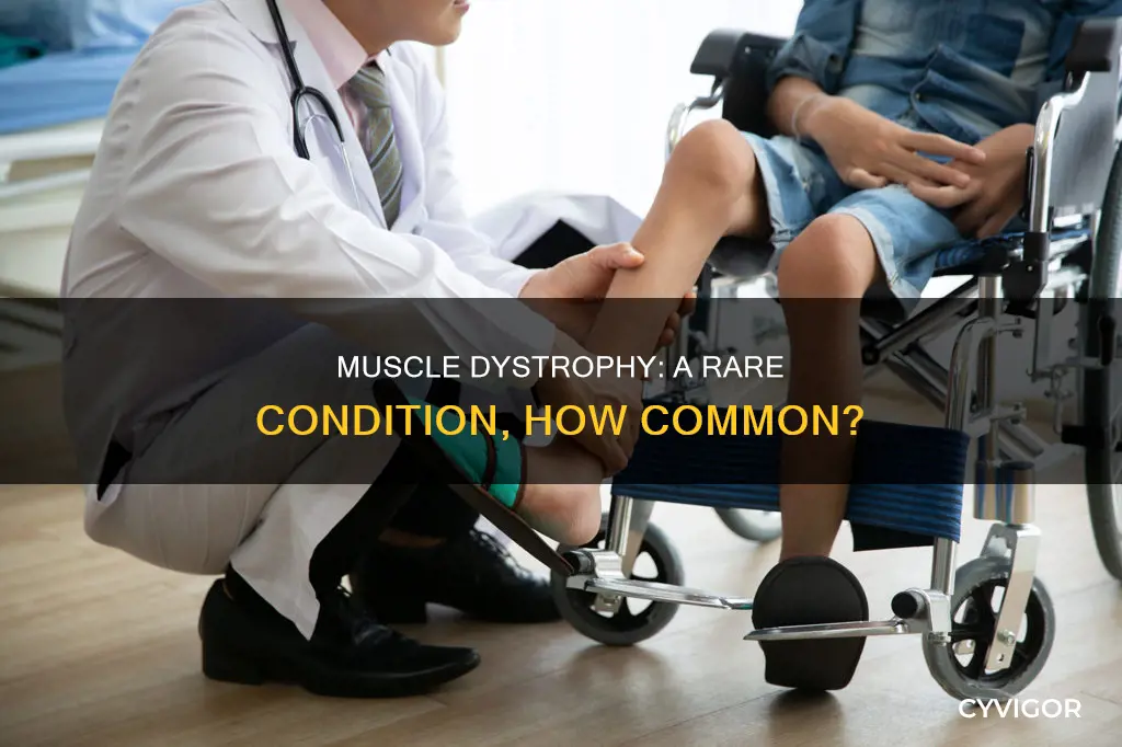 Muscle Dystrophy: A Rare Condition, How Common? | CyVigor