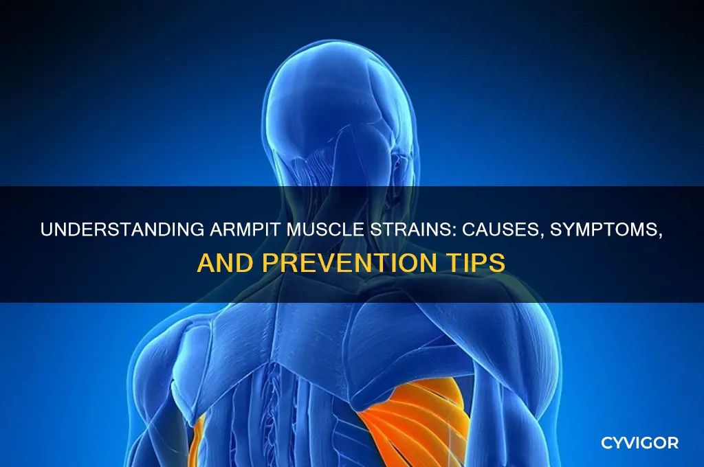 Understanding Armpit Muscle Strains: Causes, Symptoms, And Prevention ...