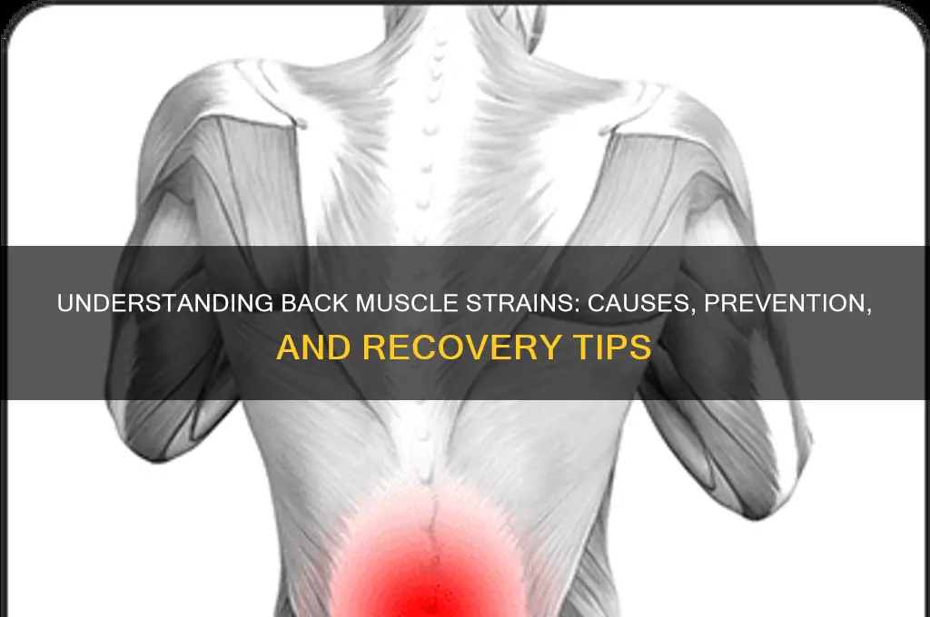 Understanding Back Muscle Strains: Causes, Prevention, And Recovery ...