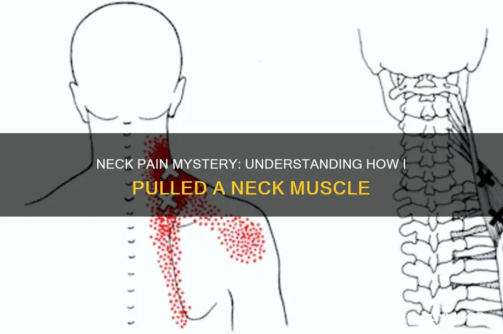 Neck Pain Mystery: Understanding How I Pulled A Neck Muscle | CyVigor