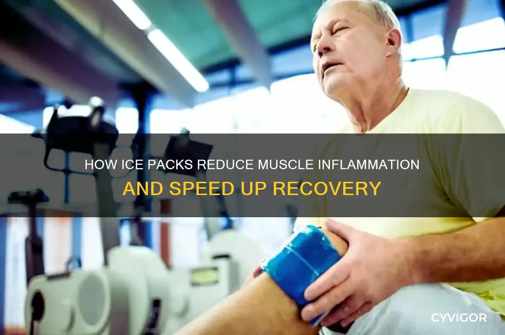 How Ice Packs Reduce Muscle Inflammation And Speed Up Recovery | CyVigor