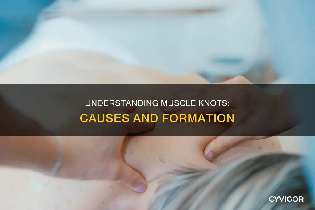 Understanding Muscle Knots: Causes And Formation | CyVigor
