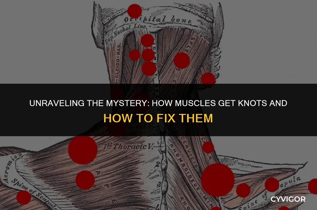 Unraveling The Mystery: How Muscles Get Knots And How To Fix Them | CyVigor